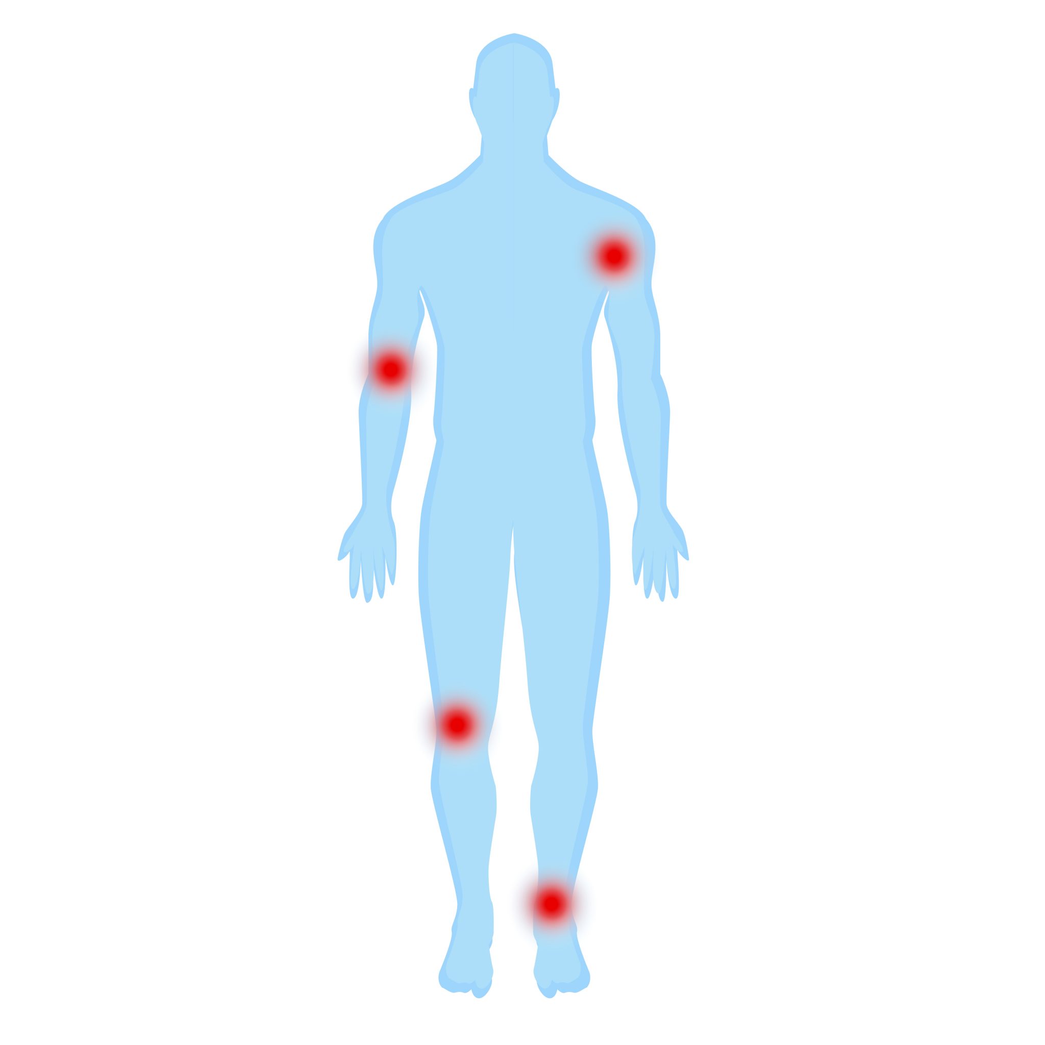What is the Difference Between Tendonitis and Bursitis? - High Mountain ...